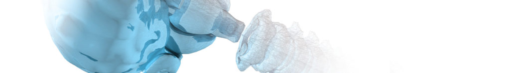 Gliome | Neurochirurgie Zürich